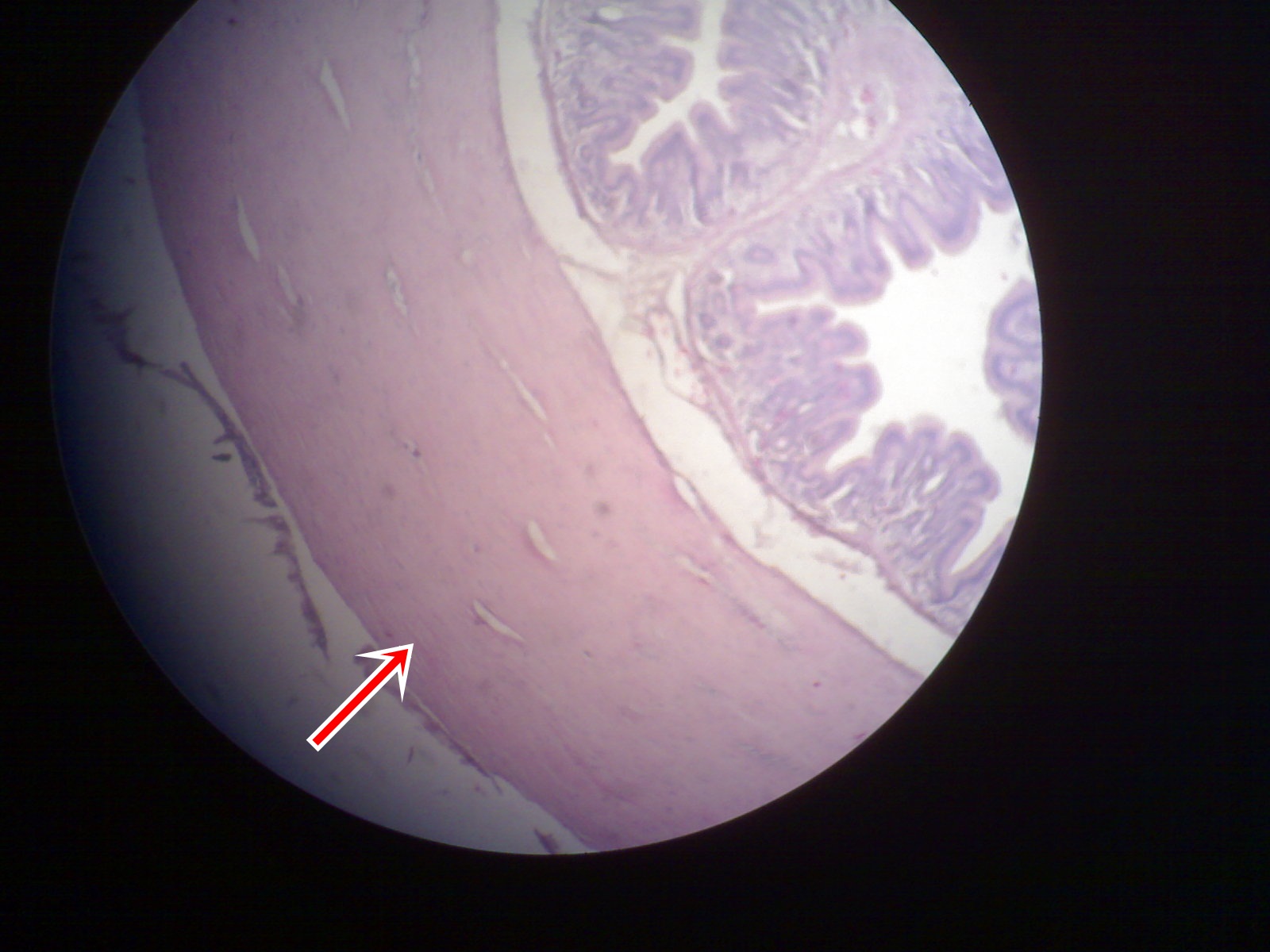 Brain & Soul Energy: Epithelium