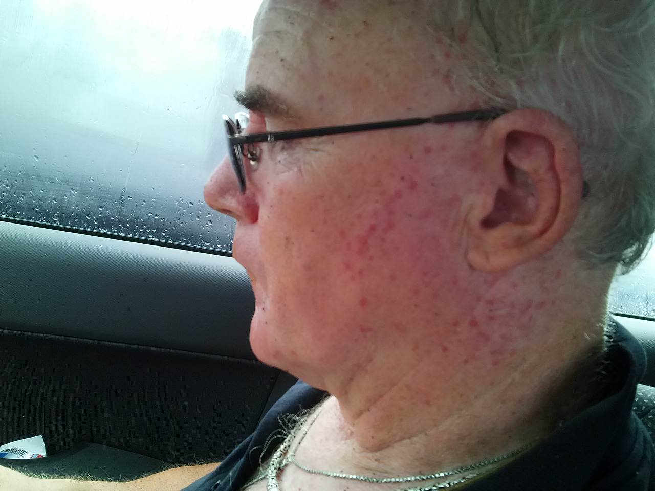 Prismatic Palette: Ireland: Crough Patrick