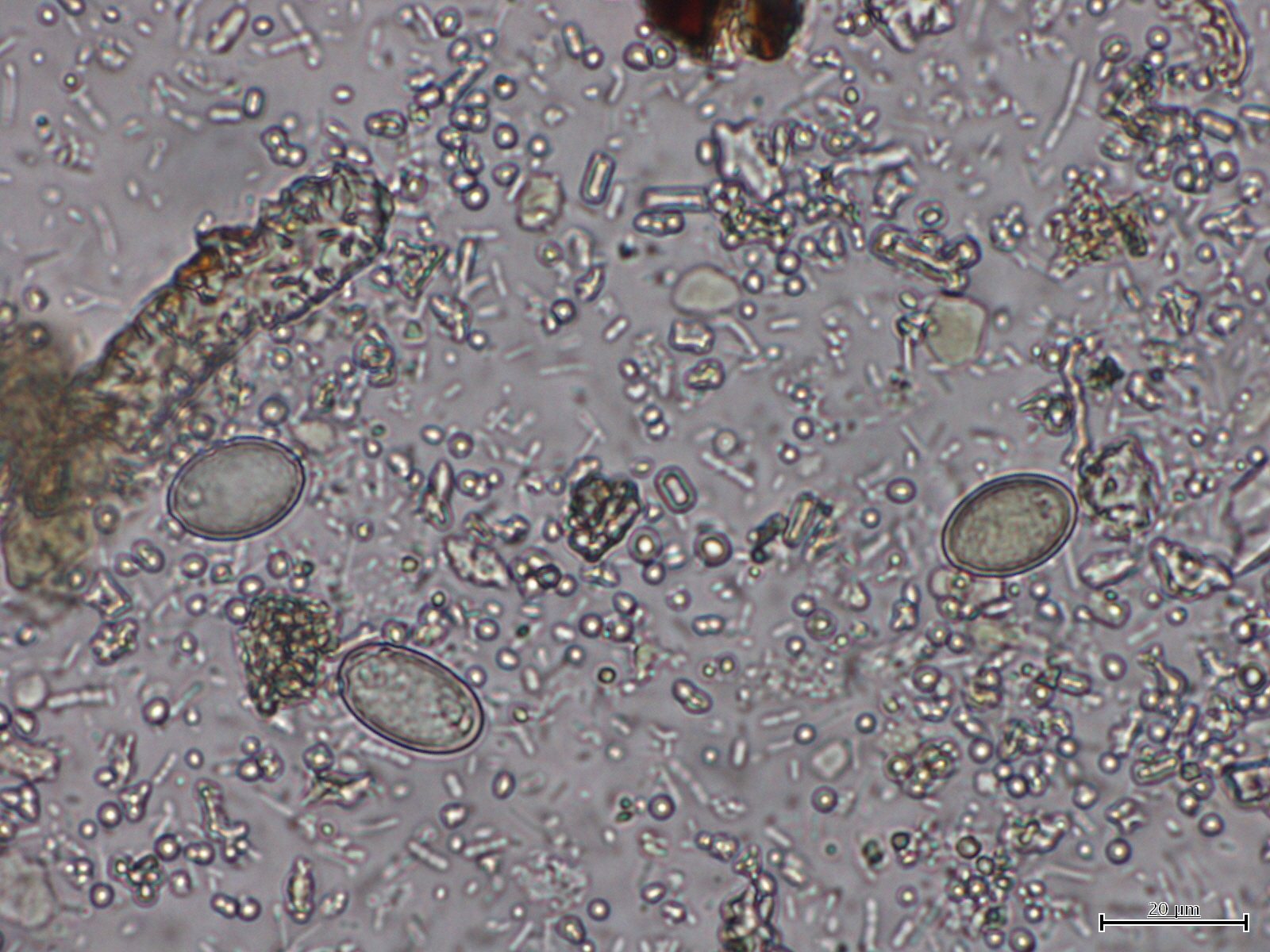 Budding Yeast Wet Mount
