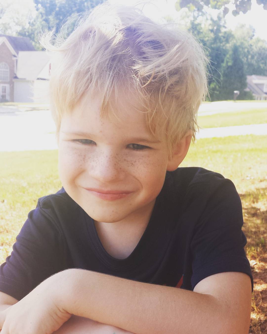 Thomas Jolley - Duane Syndrome, Klippel Feil Syndrome and Beyond ...