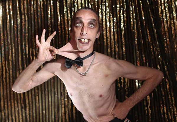 Gary 'Stretch' Turner : Man with the world's stretchiest skin | Most ...