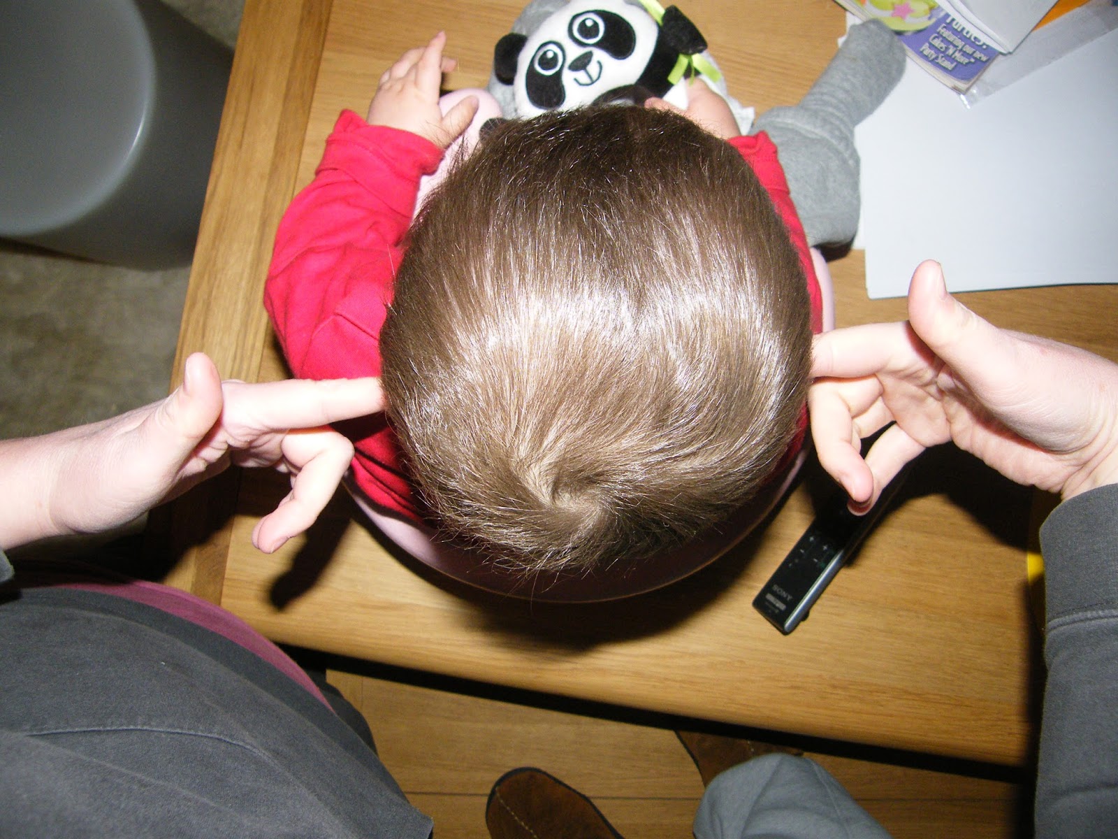 Plagiocephaly Treatment in the UK: Evren's Before and After Helmet Photos