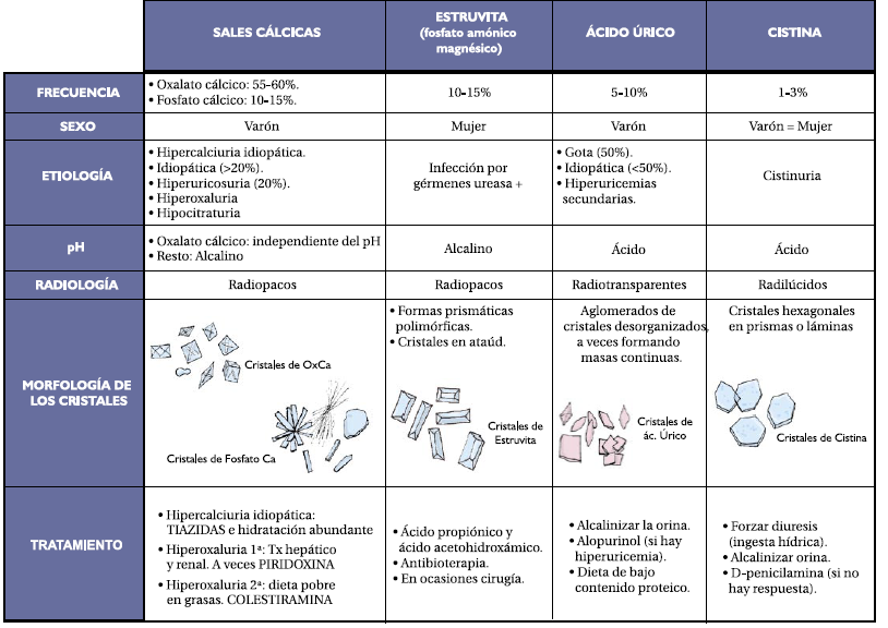 Un paseo por la ciencia: LITIASIS RENAL
