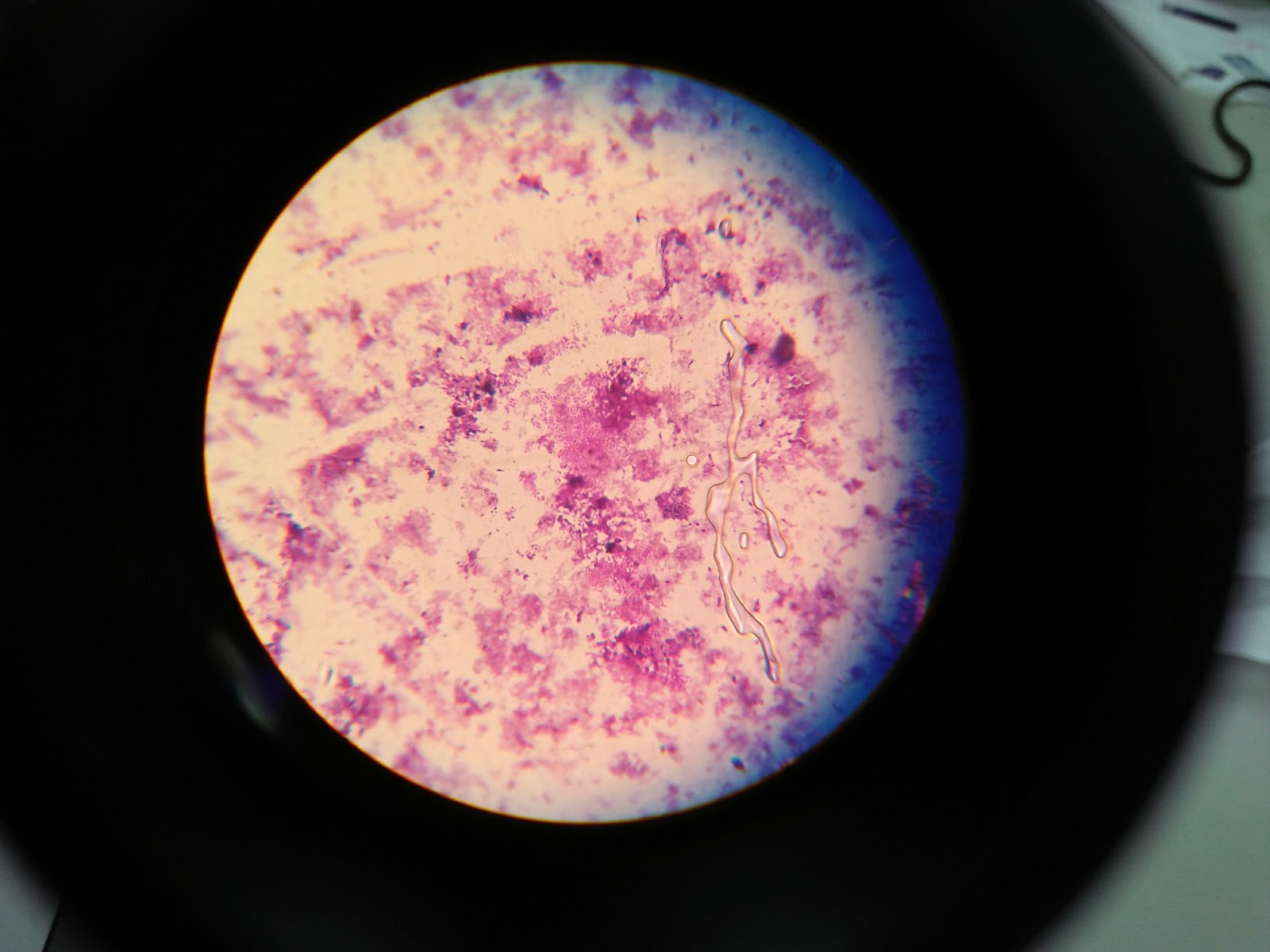 E-portfolio for teknik asas mikrobiologi: E-portfolio week 8