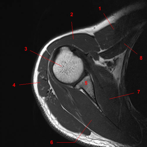 Mri Musculo Skeletal Section Mri Shoulder Axial Findings