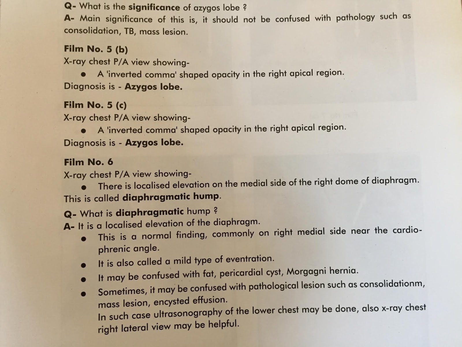 NORMAL VARIANT OF CHEST XRAY