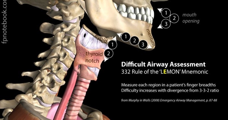 ER goldbook: Intubation management