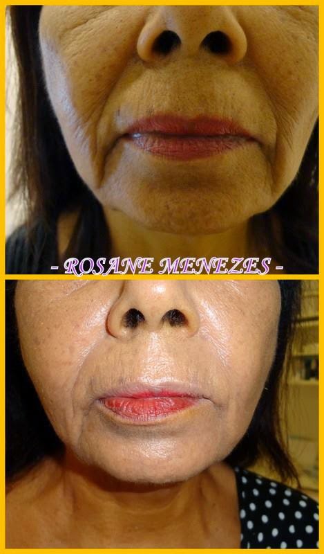 Rosane Menezes, Saúde e beleza.