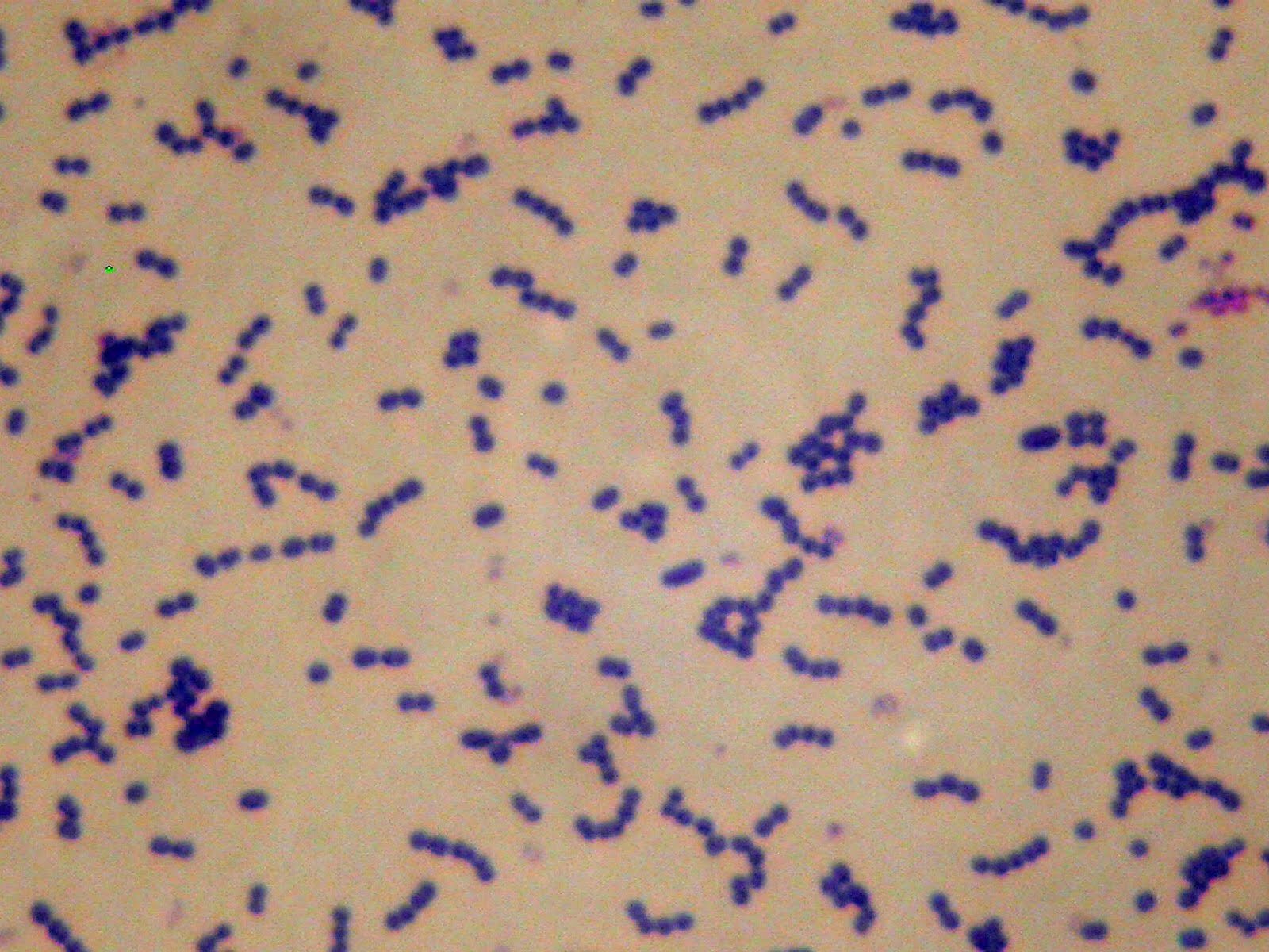 PEWARNAAN GRAM | Rahmat itu Siie Taura