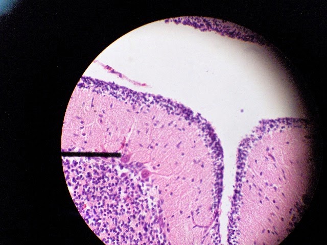 HISTOLOGIA UCC: TEJIDO NERVIOSO