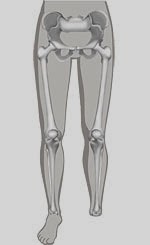 Vivre l'amputation et l'appareillage: L'amputation, pourquoi cela