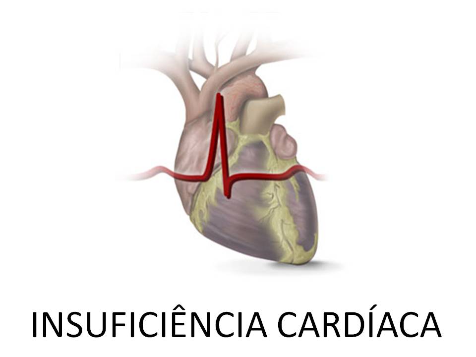 saude, noticias e atualidades...: INSUFICIÊNCIA CARDÍACA