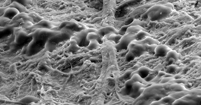 Kindergarten and Mooneyisms: Up Close - What Is It?