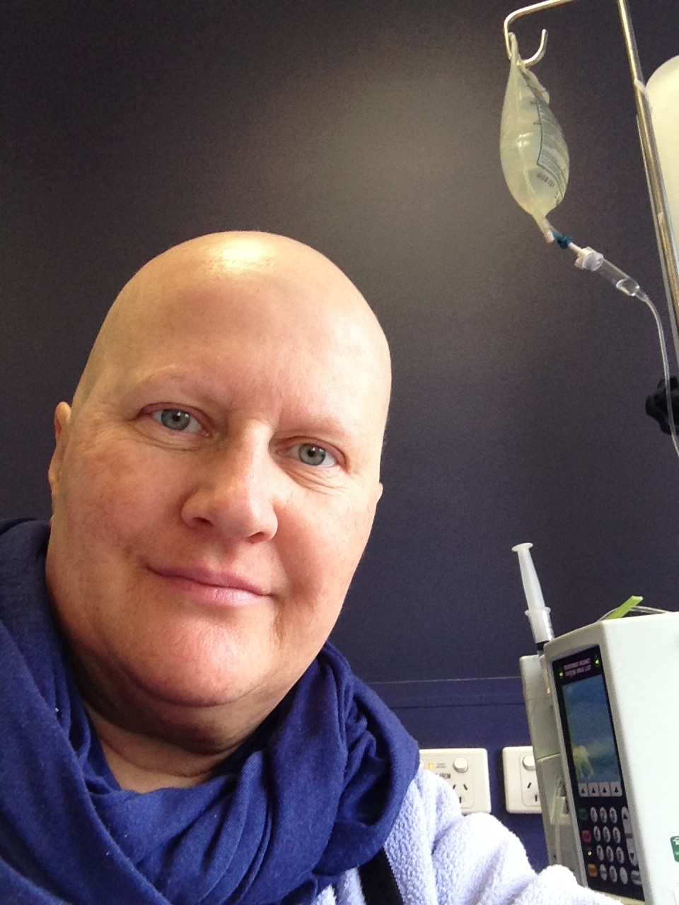 OMG! I have Breast Cancer!!! (aka Minogue's Mammary Monologues ...