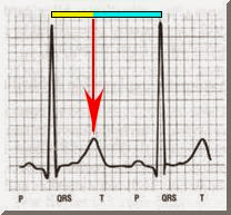 Dictionarul Lui Dumnezeu: Numarul de aur - Sirul Fibonacci - proportii ...