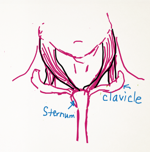 Trigger Point Tips: Dealing with Headaches: The Sternocleidomastoids