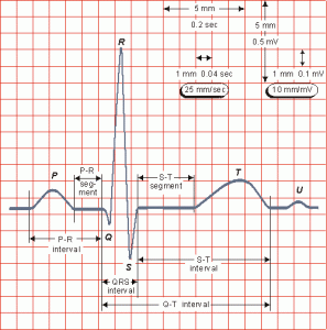 FUNDAMENTOS DE ELECTROCARDIOGRAFIA : ELECTROCARDIOGRAMA NORMAL.