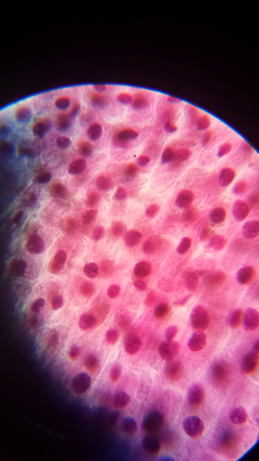 Blog de Álvaro: Determinación de la mitosis en células de raíz de cebolla.