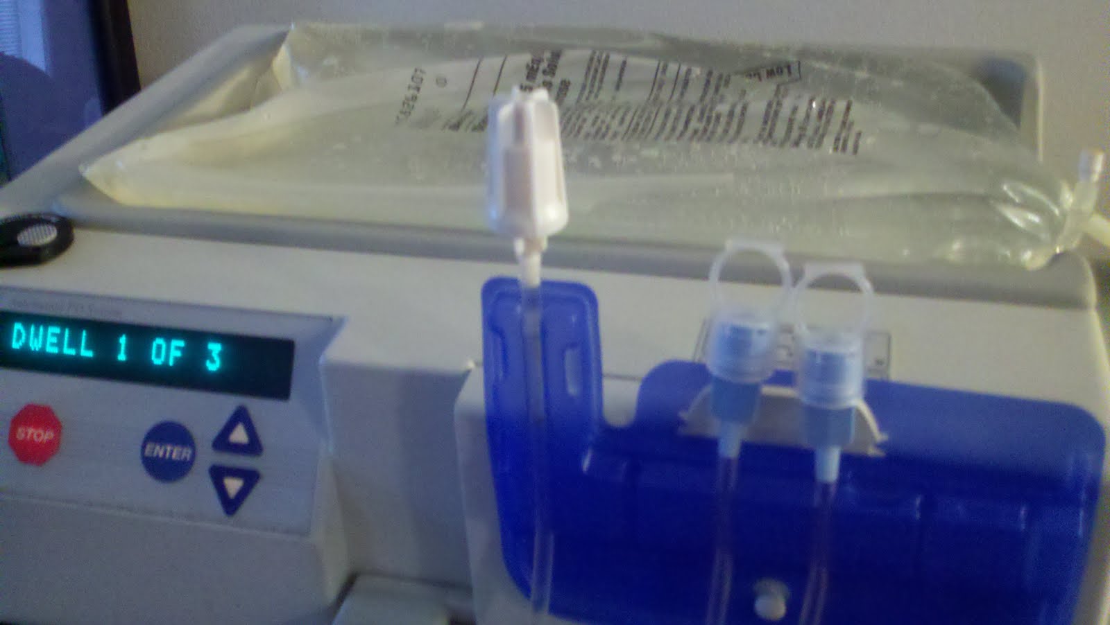 JK – Just Kidneying: Making a PACt With Baxter