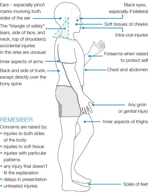 Redwood's Medical Edge: Child Abuse Injuries: Part 2/2