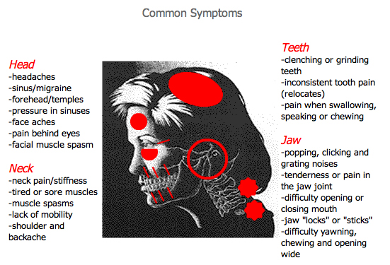 Dental sky - All about healthy smile: Temporomandibular Joint Syndrome ...
