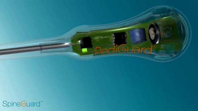 Spine Fixed In Abuja: PEDIGUARD