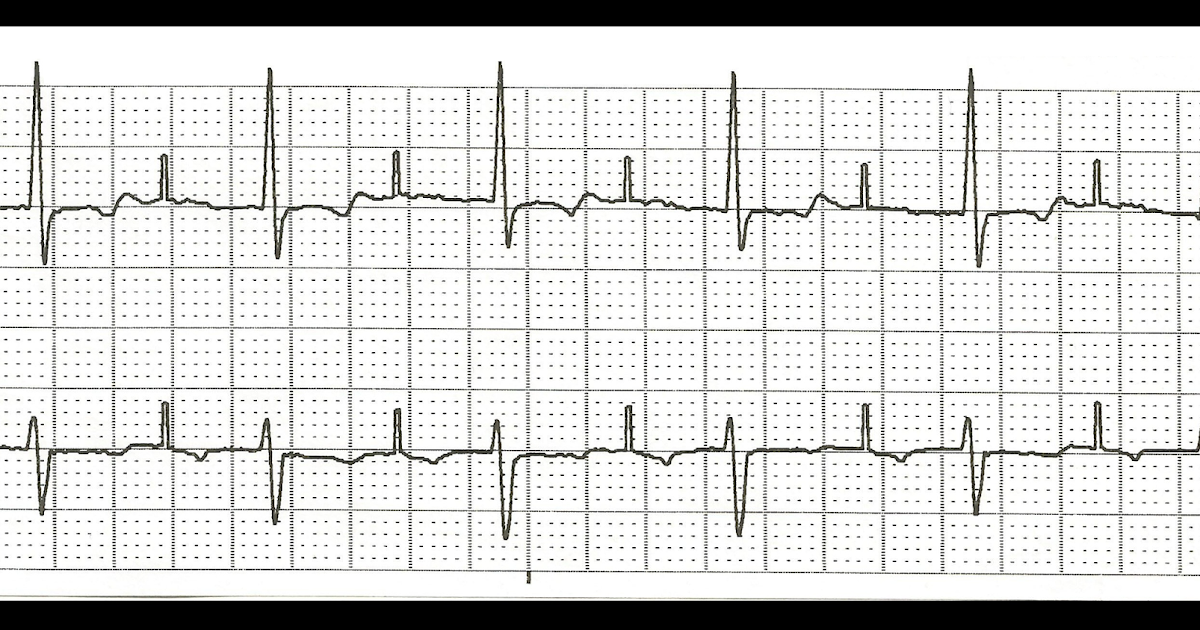 Paced Rhythms Quiz 296