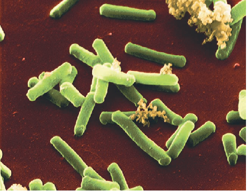 The Pharmacist Room: KASUS TETANUS