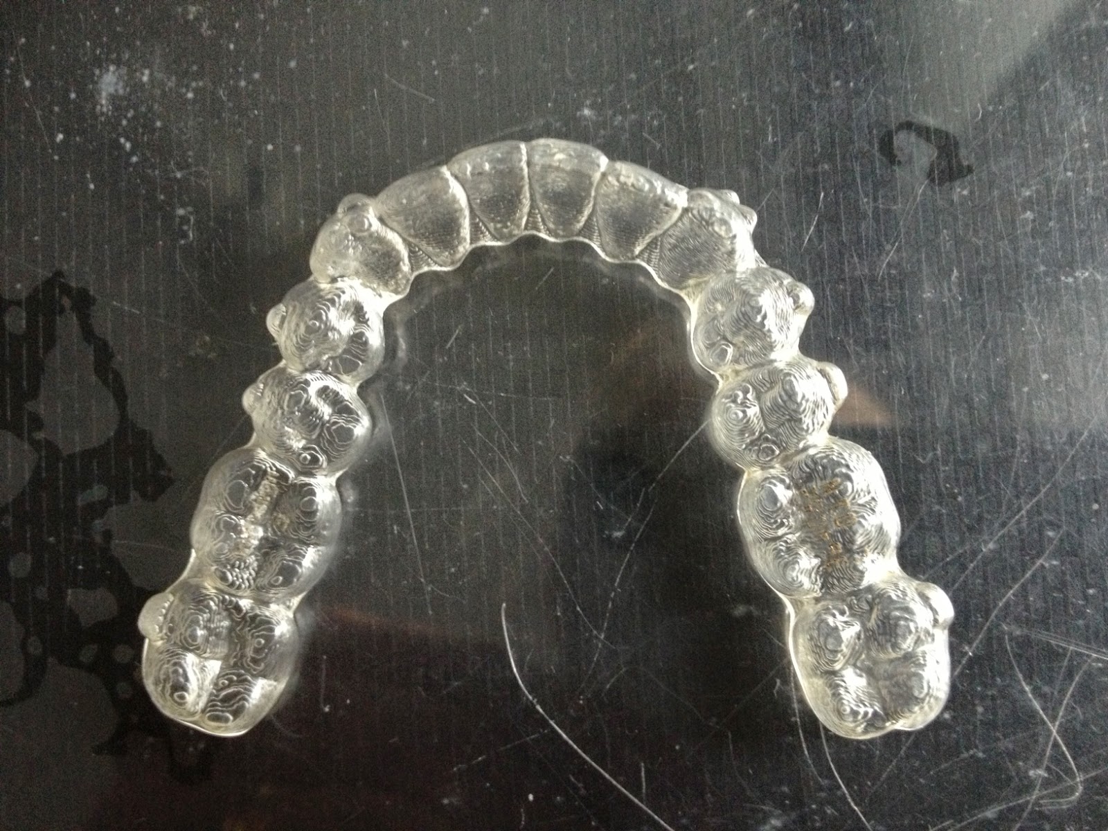 Invisalign: My first trays