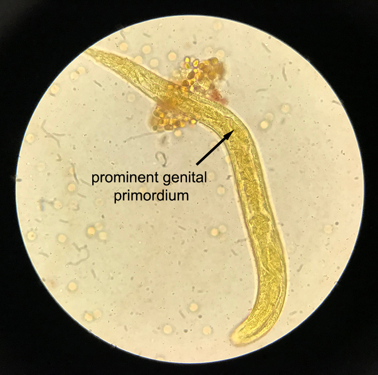 Capillaria Philippinensis Larvae