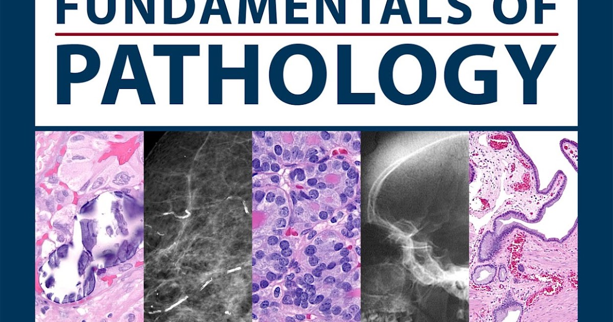 Study Medicine Online: Pathoma Dr.Husain A. Sattar's review for ...