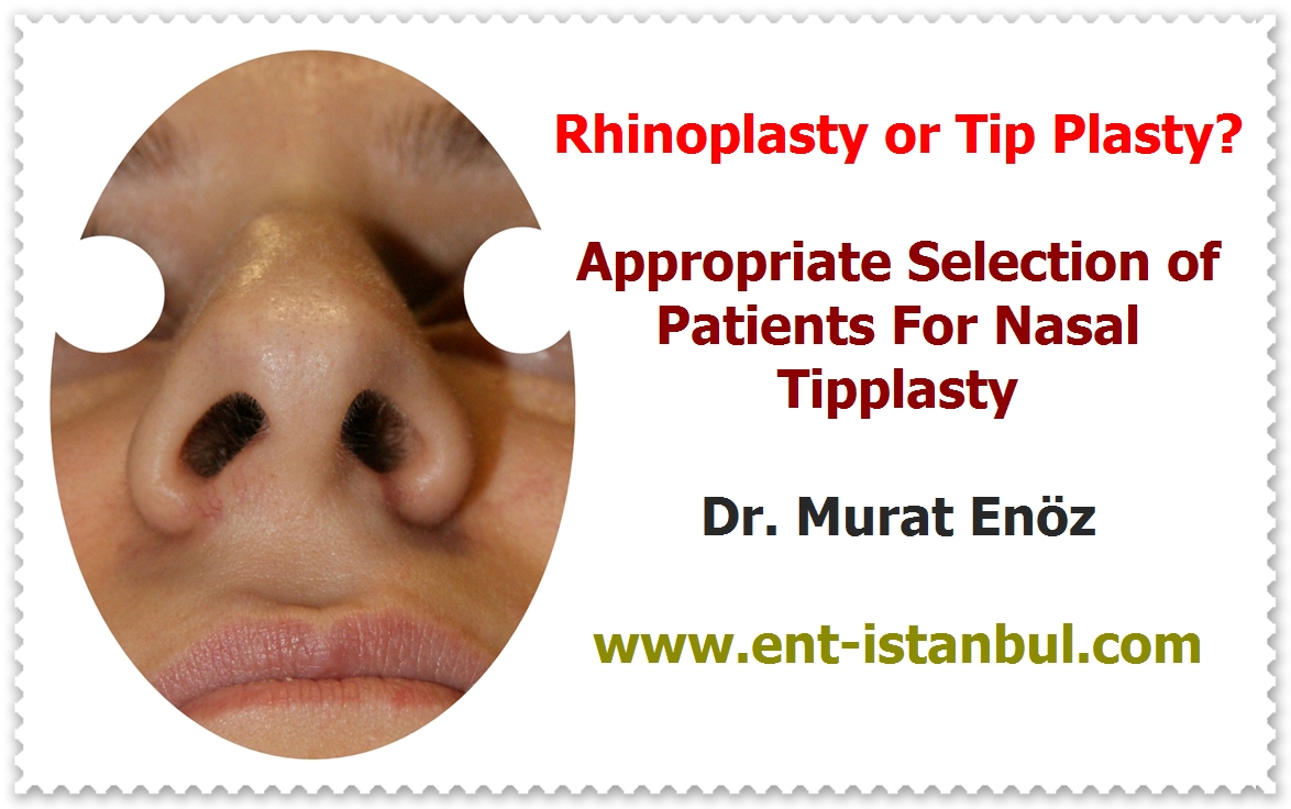 Nasal Tip Refinement: Creating A Natural Appearing Nasal Tip