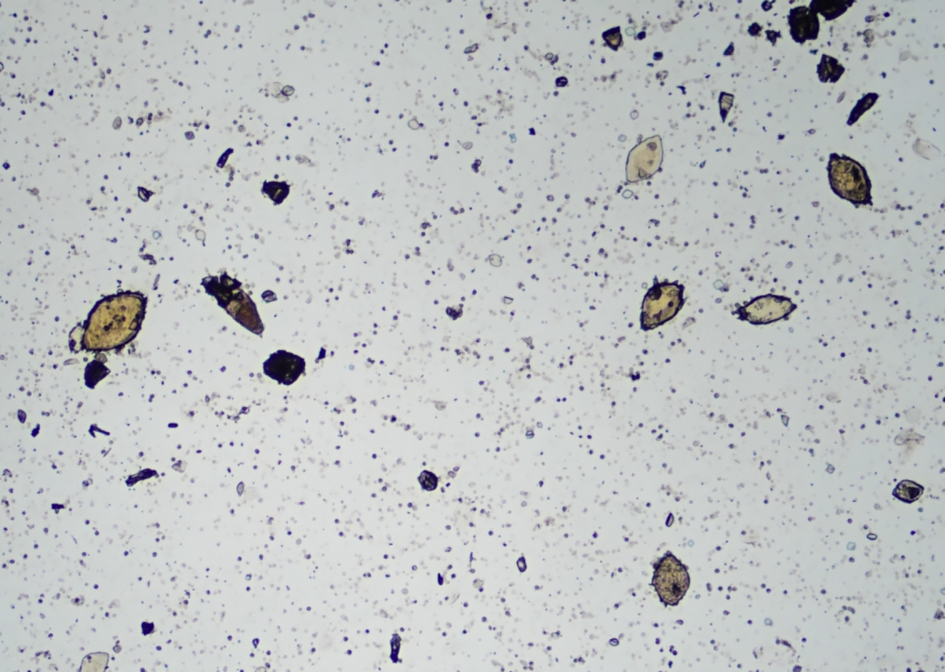 Creepy Dreadful Wonderful Parasites: Case of the Week 511