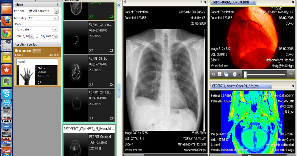 Linux DICOM Viewer | iheartubuntu