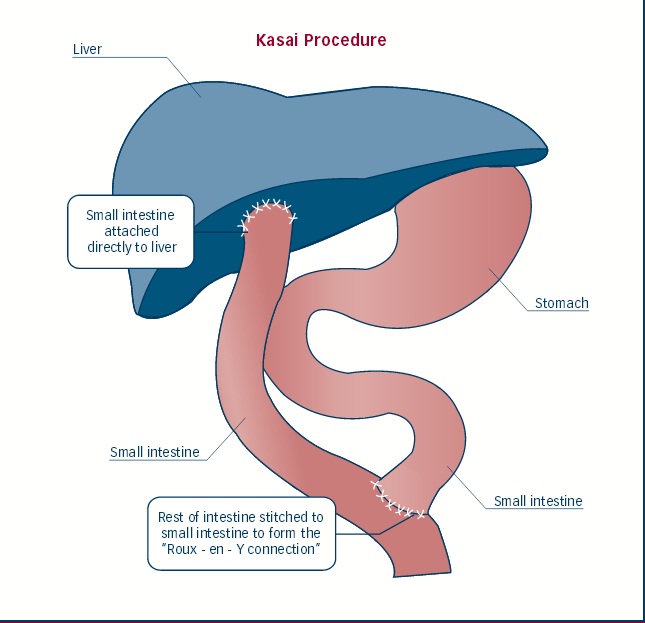 Diari Salasiah: August 2013