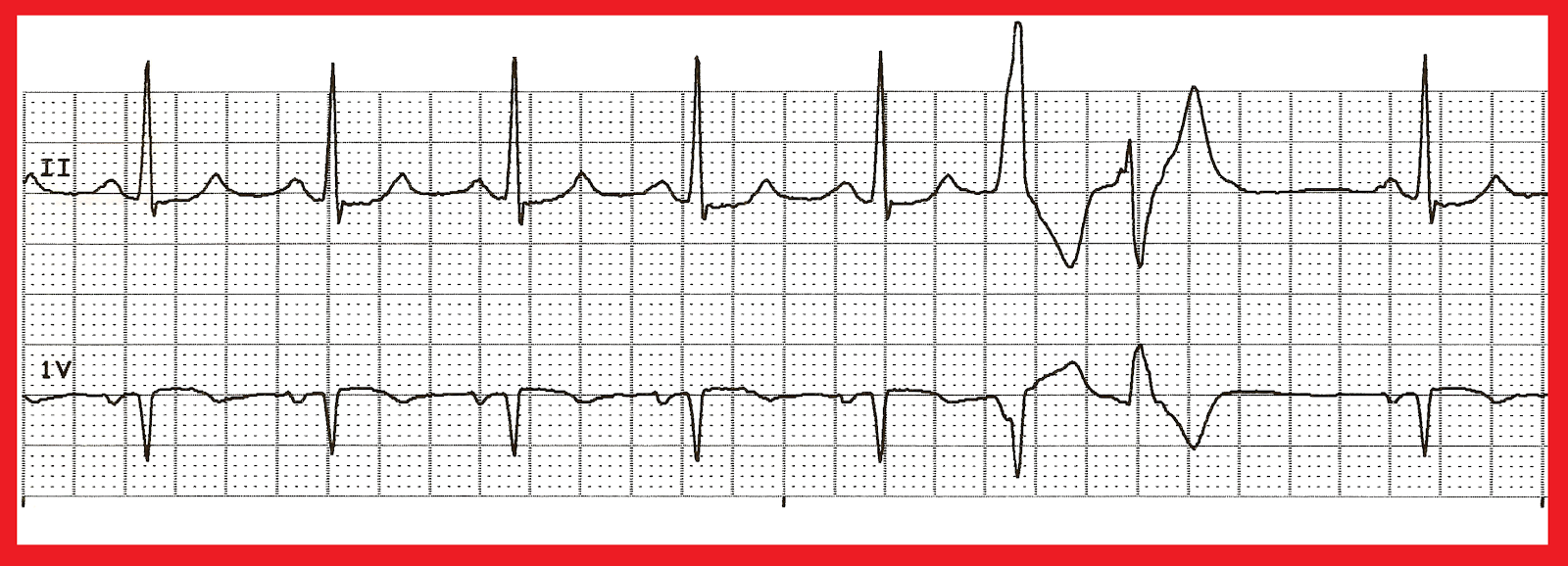Basic EKG Rhythm Test 16