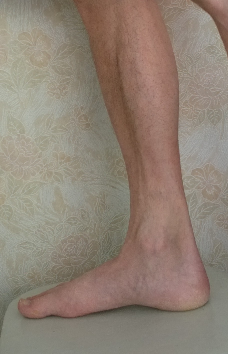 Kauneus blogi: JALKOJEN RAKENNEANALYYSI MIES 53V.