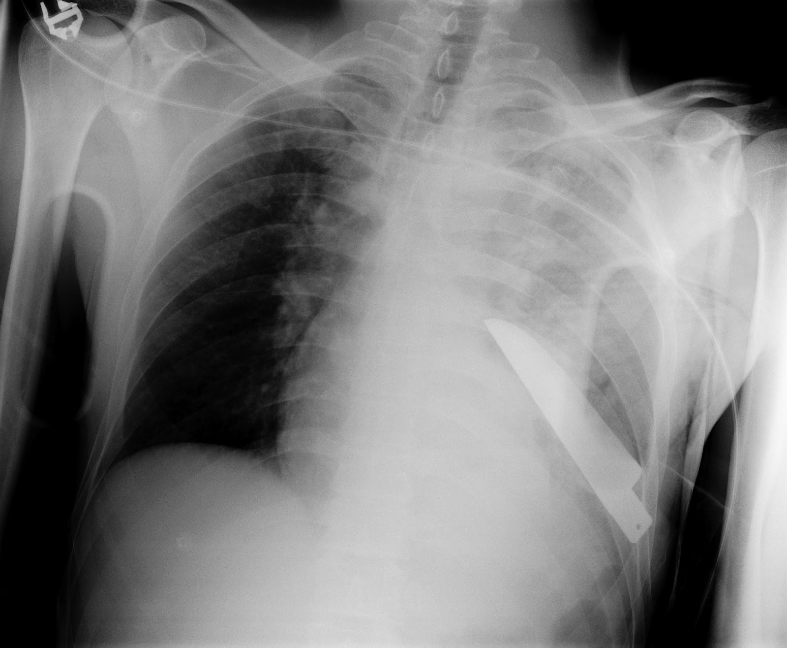 Arquivos do Sr. Wilson: Algo sobre primeiros socorros