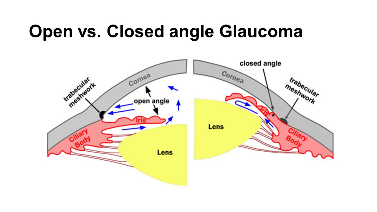 Syima Yusuf: Penyakit Glaukoma Boleh Membutakan Mata
