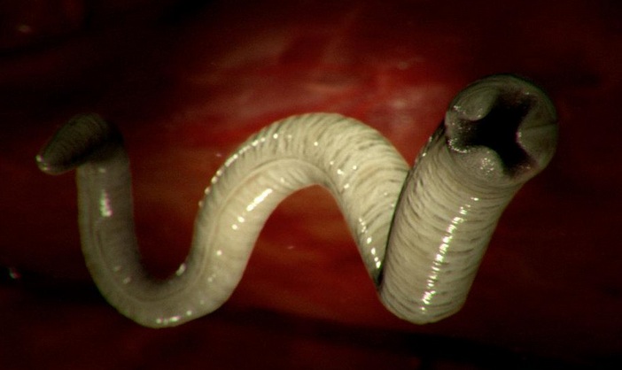 Poletka zdrowia: Ratuj zdrowie póki pora, OBCY W NAS