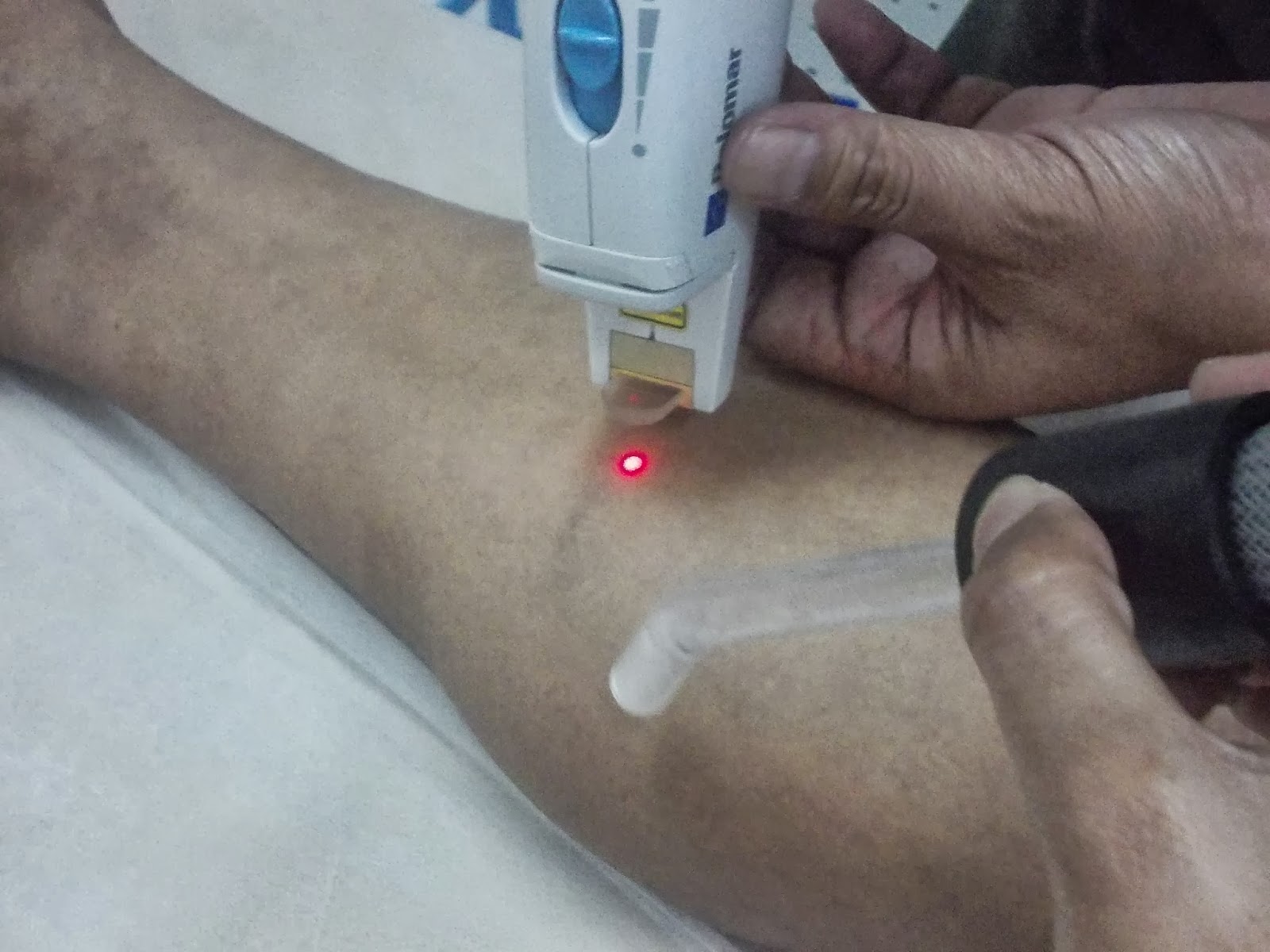 RUANG PRAKTEK BEDAH - DOKTER RAMZI SPB (K) V: 2 cara menghilangkan ...