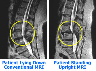 Orthopedic MRI (Stand Up MRI)