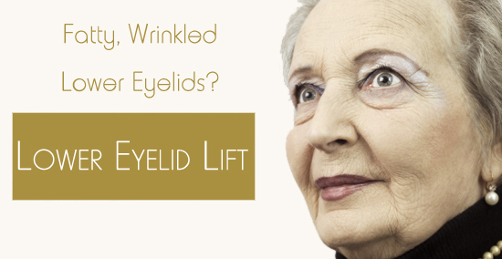 Eyelid Surgery Legend Dr. Kim Byung Gun: [BK Plastic Surgery Hospital ...