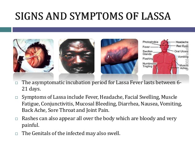 What is Lassa Fever + Pictures