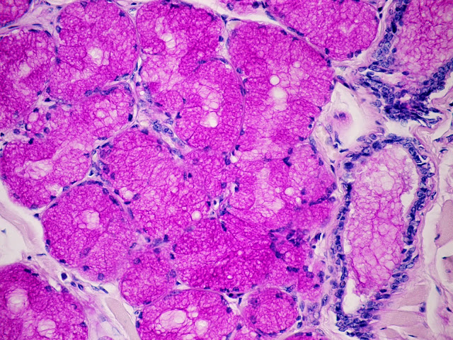 Histología en Imágenes : GLANDULA SEROSA O MUCOSA??
