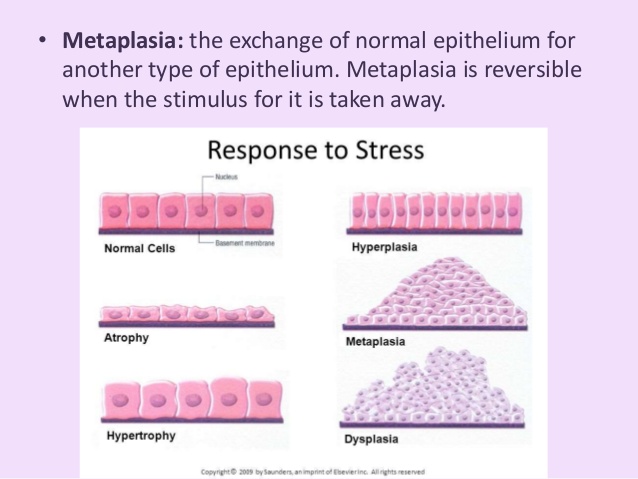 EXAMS AND ME : Metaplasia