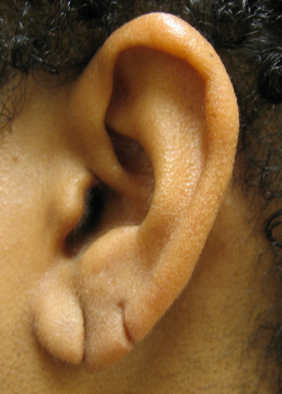 Show me your Belly Button.......: Earlobe Disasters