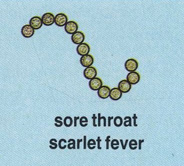 Scarlet Fever Bacteria Shape