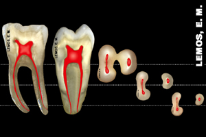 Endodontia e Estética