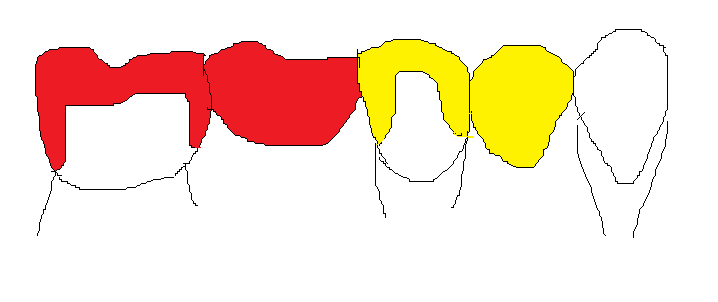 Pier (intermediate) bridge abutments